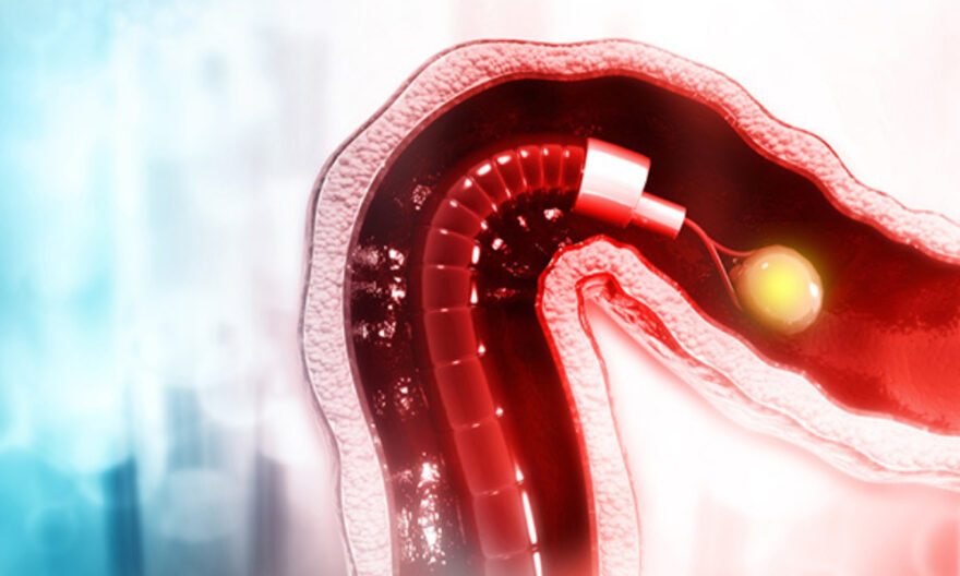 Navigating the Process: Understanding the Results and Follow-up After a ...