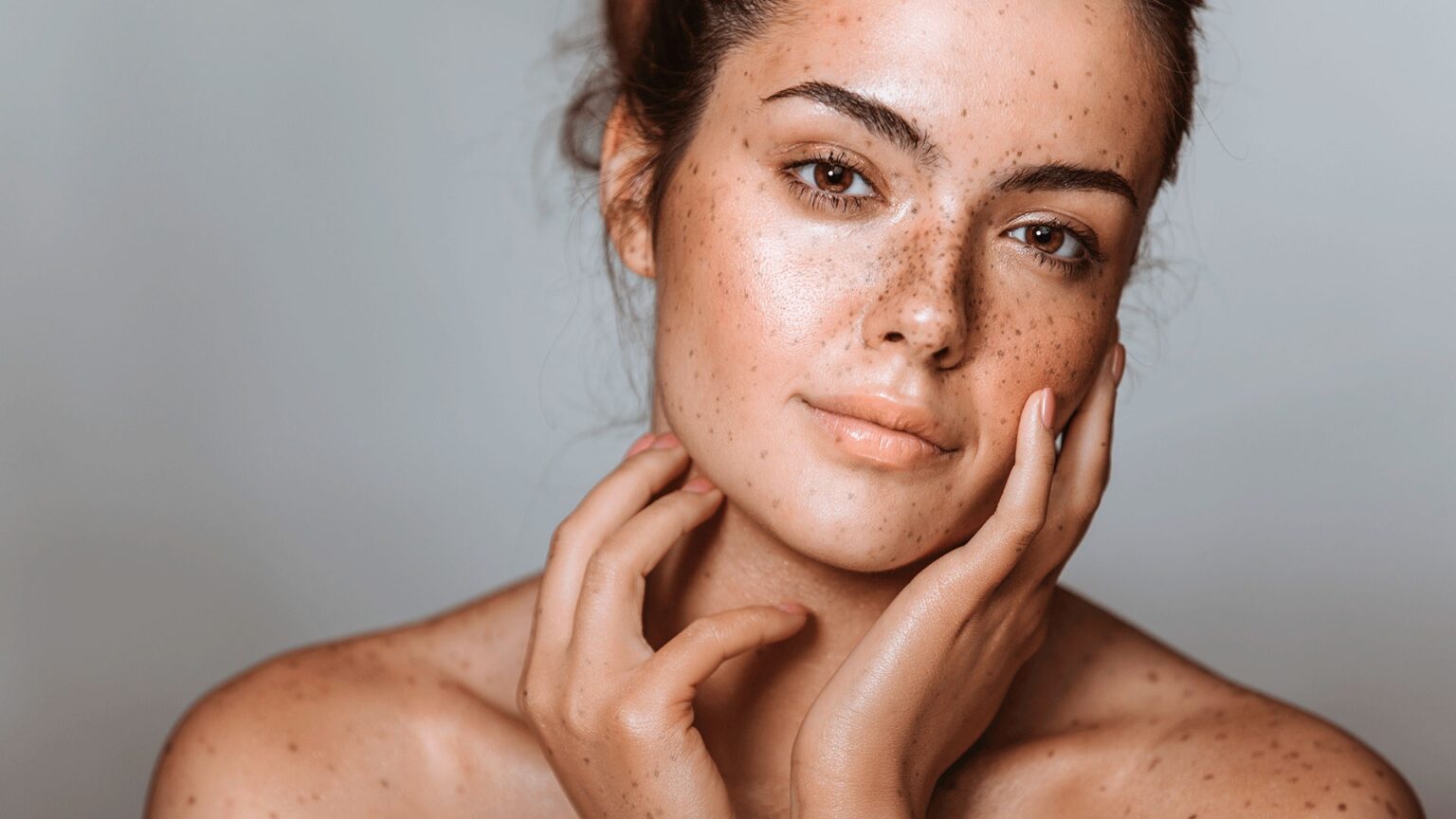 Understanding Facial Pigmentation: Causes, Types, and Solutions - Body ...